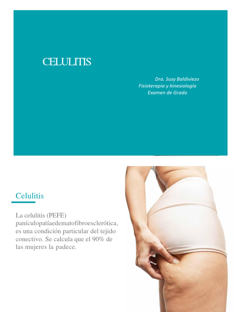 CELULITIS | PDF | Piel | Sistema circulatorio