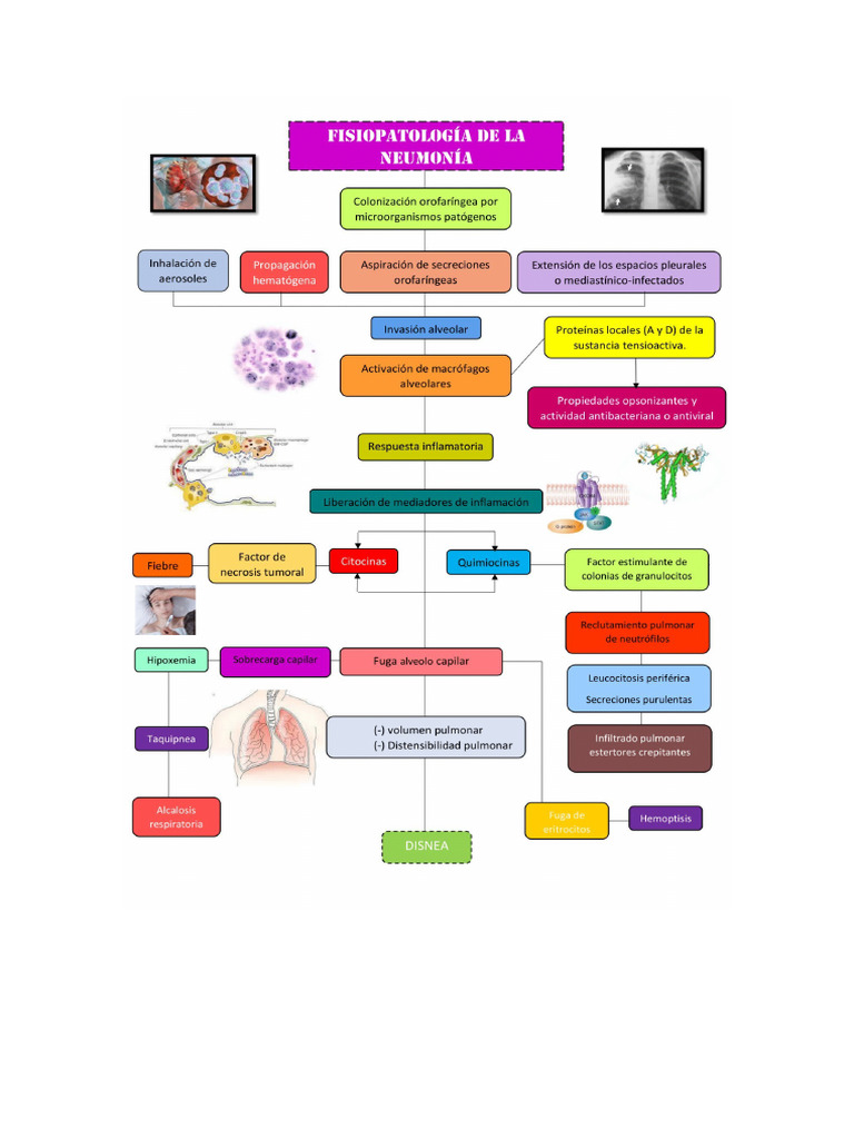 Fisiopatología de la neumonía | PDF