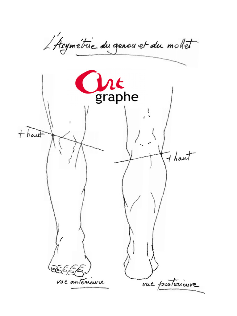 Dessin Jambe Mollet Asymetrie | PDF