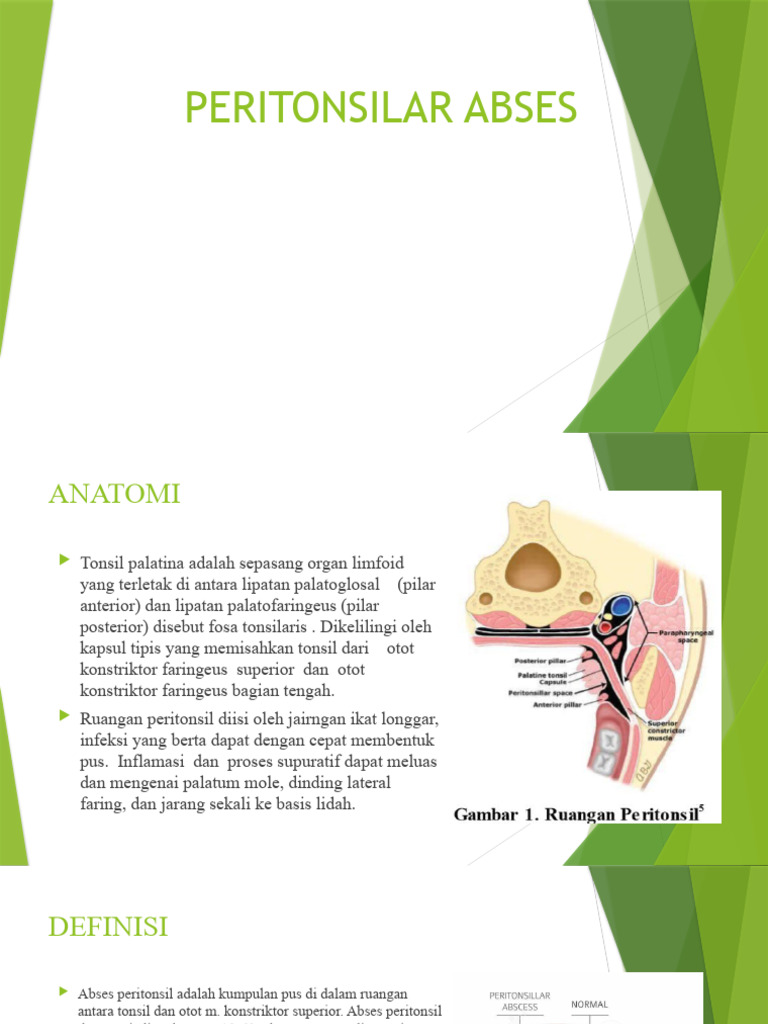 Peritonsilar Abses | PDF
