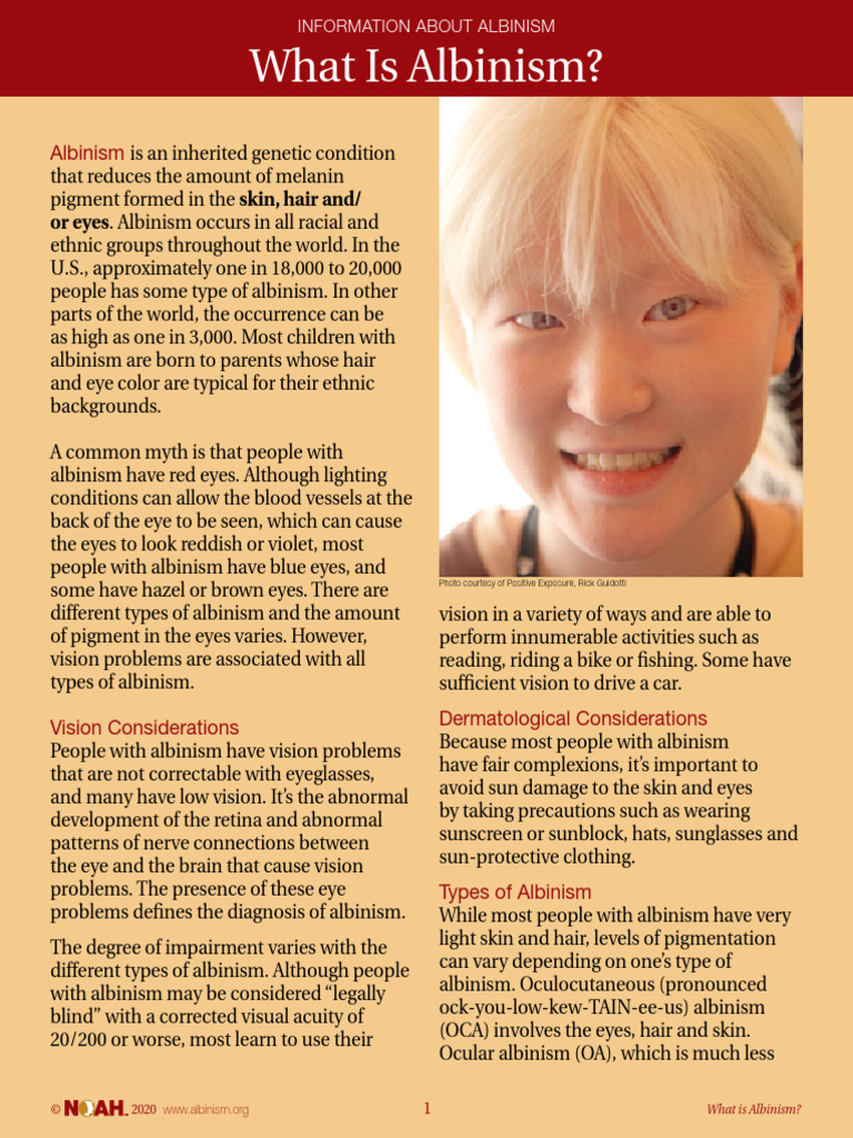 NOAH What Is Albinism - 2020 - Low Res | Download Free PDF | Clinical ...
