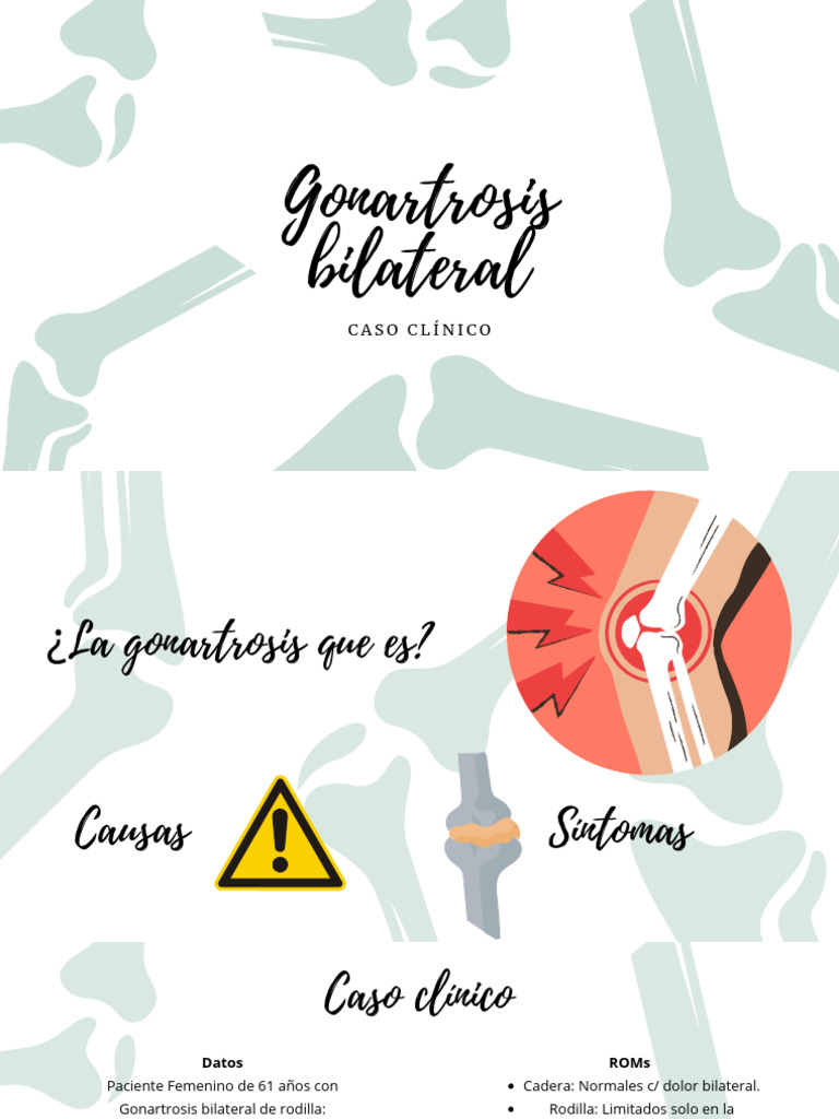 Gonartrosis Bilateral: Caso Clínico y Tratamiento | PDF | Rodilla | Dolor