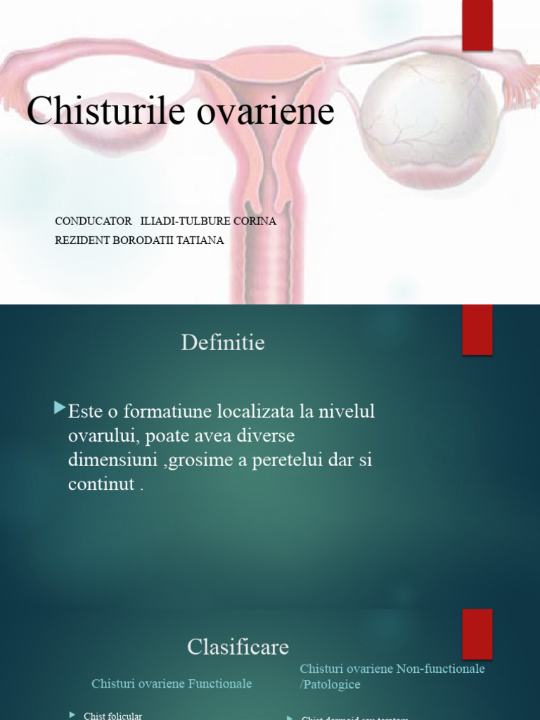 Chist Ovarian | PDF