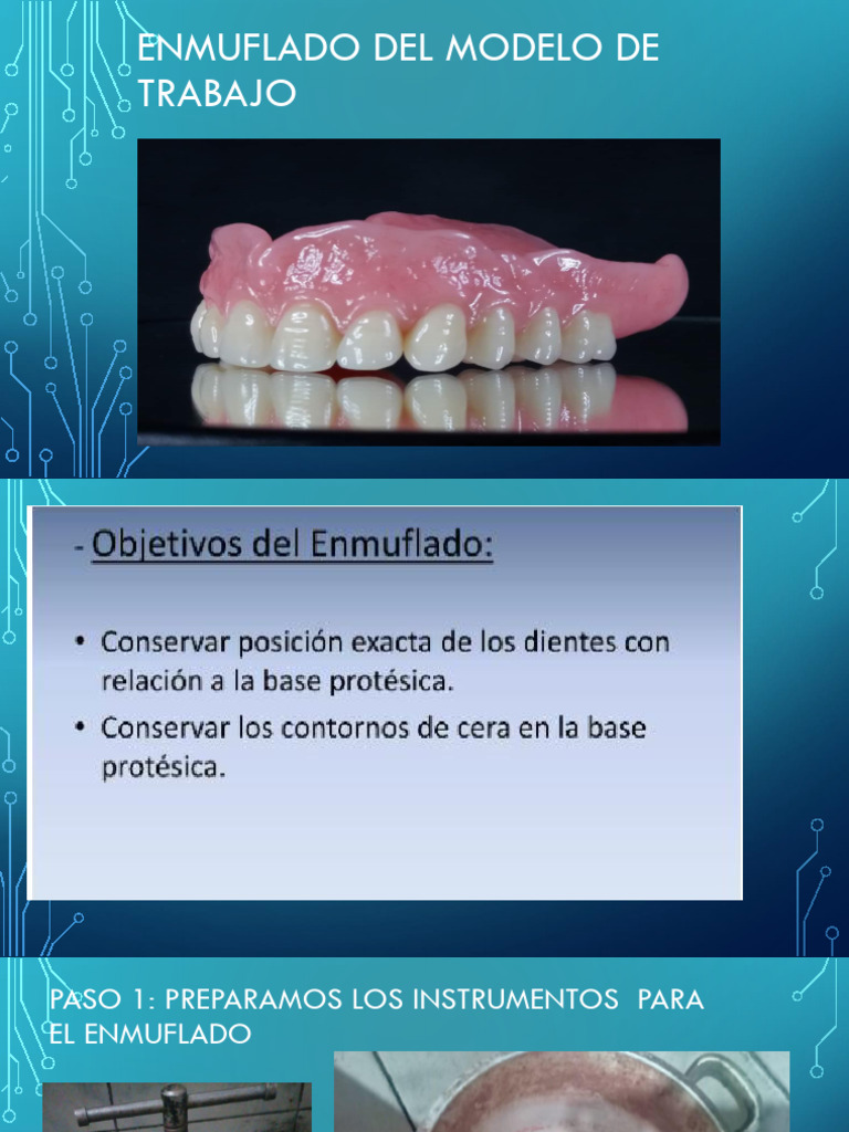 Enmuflado y acrilizado de prótesis dental | PDF | Tecnología