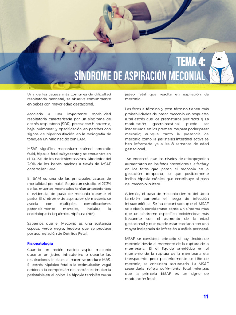 4 Sindrome de Aspiracion Meconial | PDF | Feto | Medicina 4 Sindrome de Aspiracion Meconial | PDF | Feto | Medicina