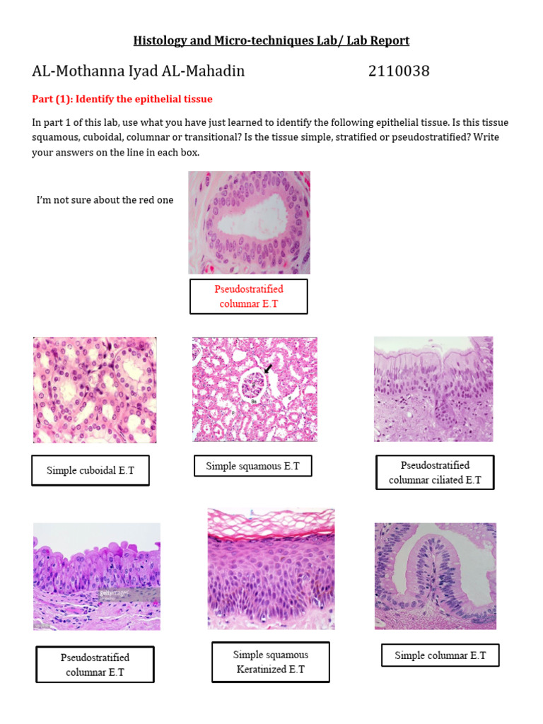 Histology Lab: Epithelial Tissue | PDF