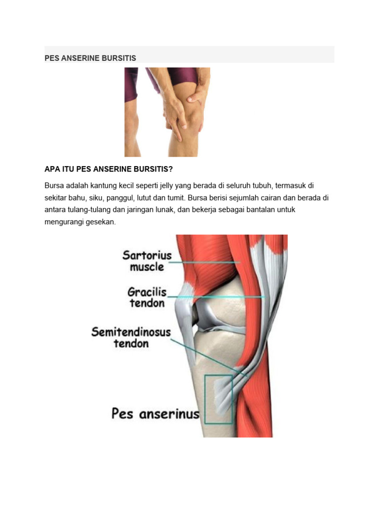 pES ANSERINE BURSITIS | PDF