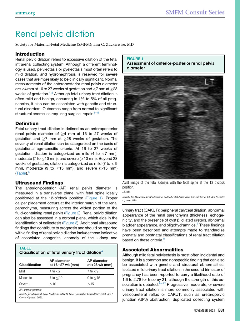 PIIS0002937821006761 | PDF | Kidney | Prenatal Development