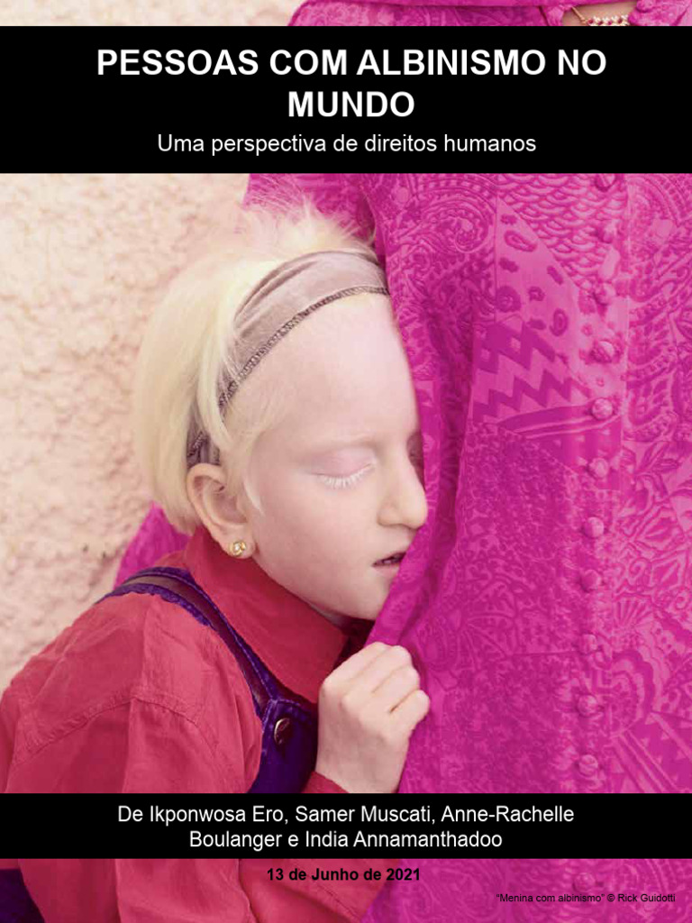 Albinism Worldwide Report2021 PT | PDF