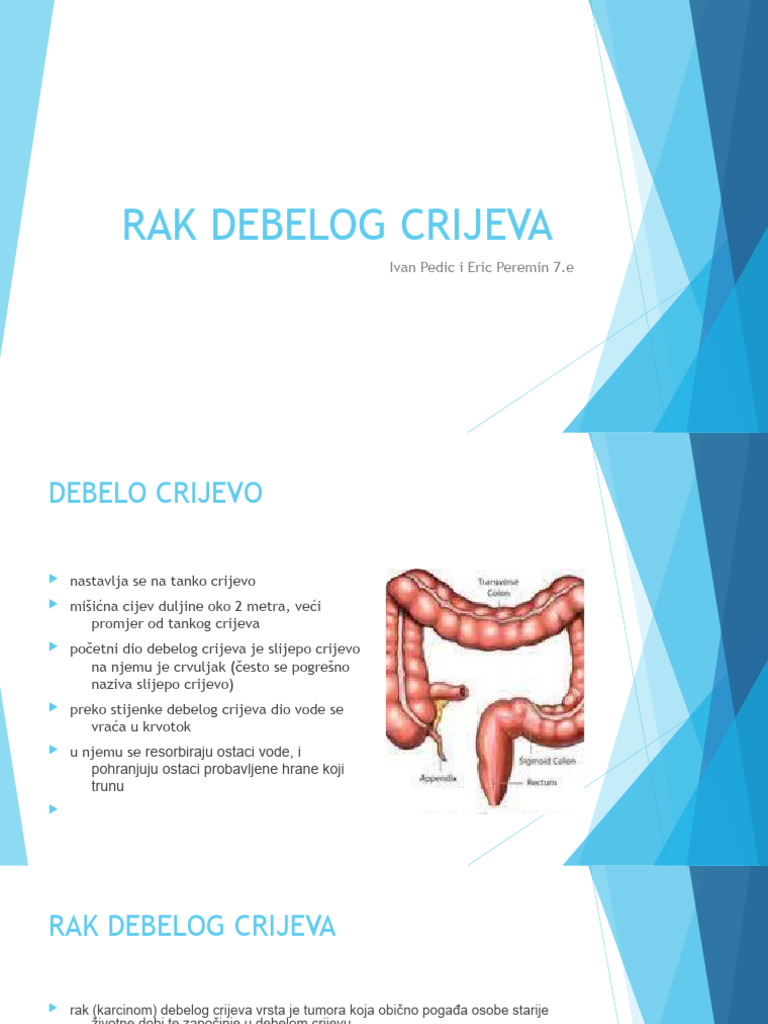 Rak Debelog Crijeva | PDF