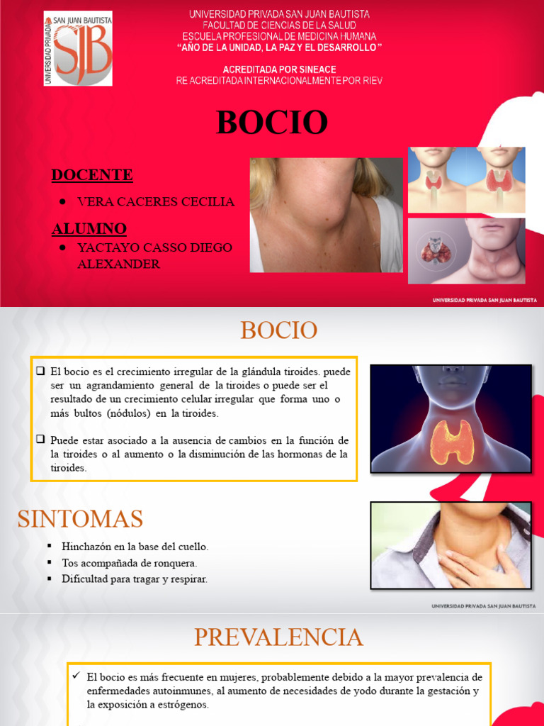 Bocio Teoria | PDF | Tiroides | Hipertiroidismo