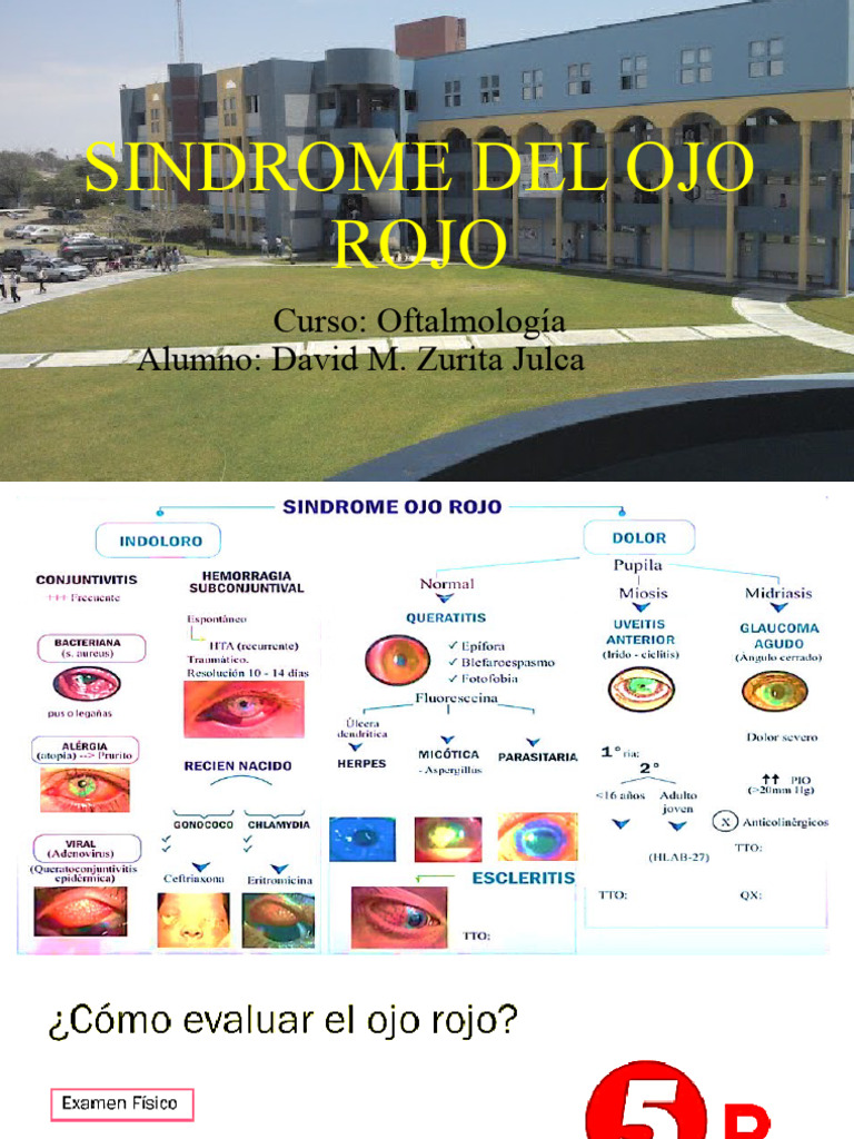 Sindrome Ojo Rojo | PDF | Ojo humano | Glaucoma