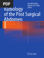 Laparoscopic Cholecystectomy With IOC | PDF | Gallbladder | Liver