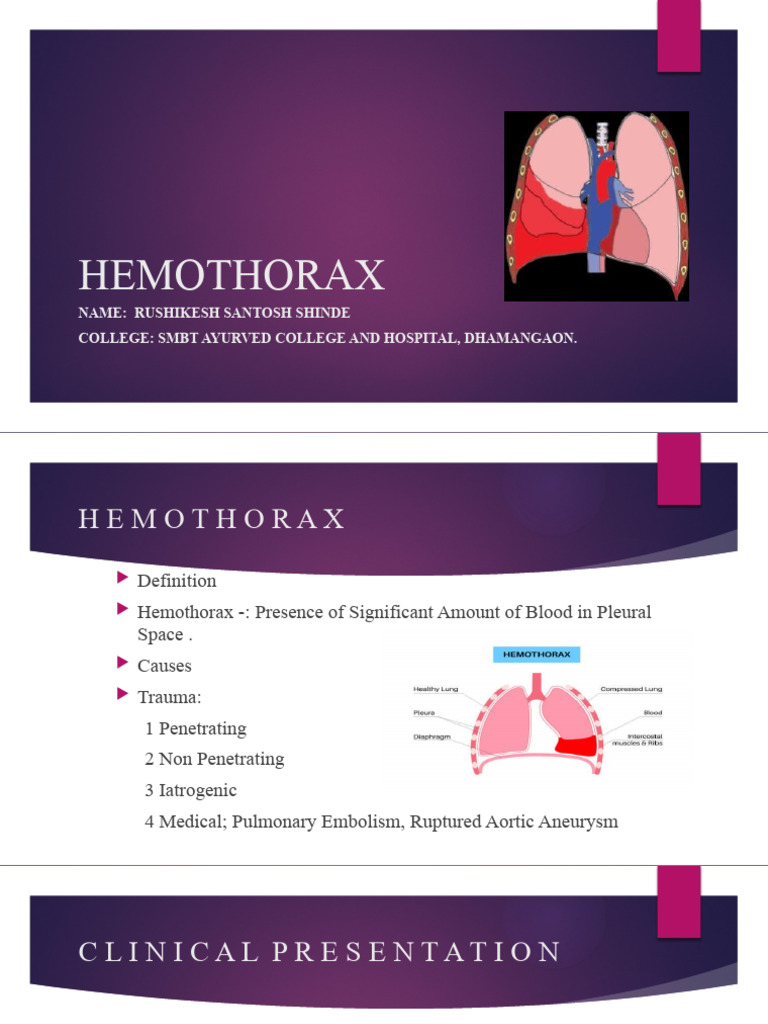 Understanding Hemothorax: Causes & Management | PDF | Self-Improvement ...