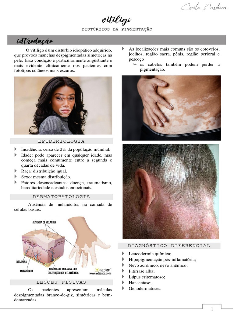 Vitiligo | PDF
