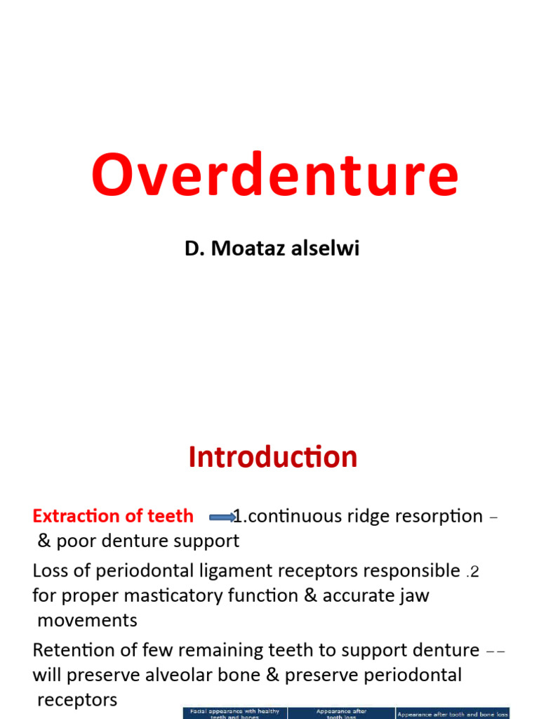Over Denture | PDF