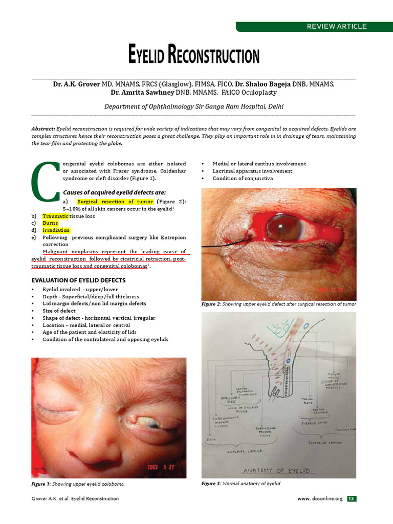 Eyelid Reconstruction | Download Free PDF | Medical Specialties | Human ...