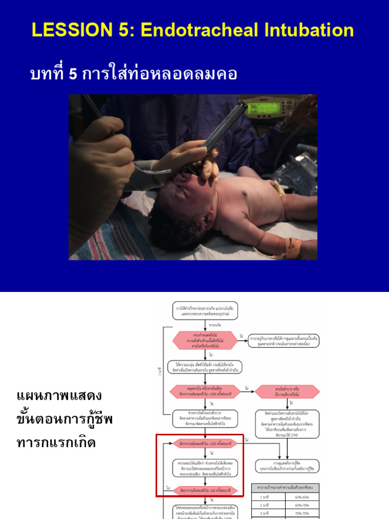 Lesson 5 NRP 8th Intubation | PDF