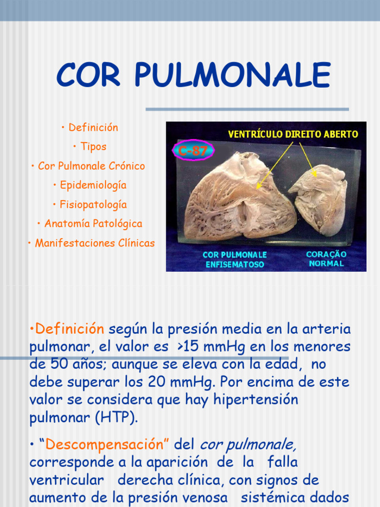 C Cor Pulmonale | PDF | Embolia | Electrocardiografia