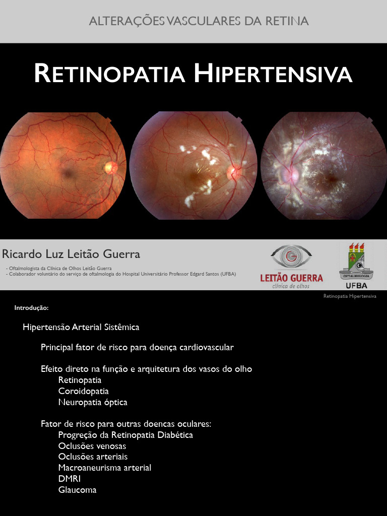 Retina 4 - Retinopatia Hipertensiva | PDF | Hipertensão | Angiologia