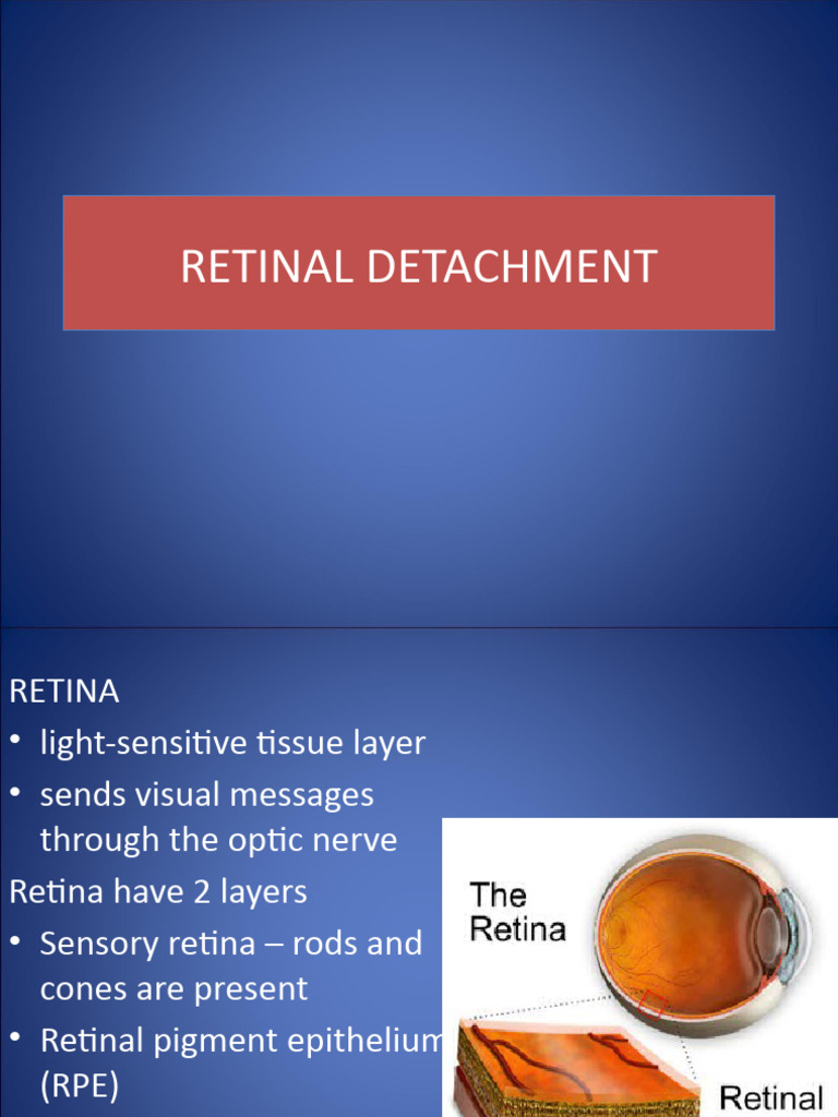 Retinal Detachment | PDF