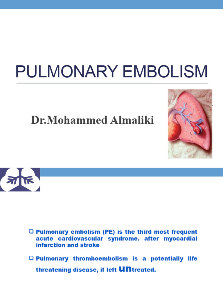 Pulmonary Embolism | PDF | Thrombosis | Medical Specialties