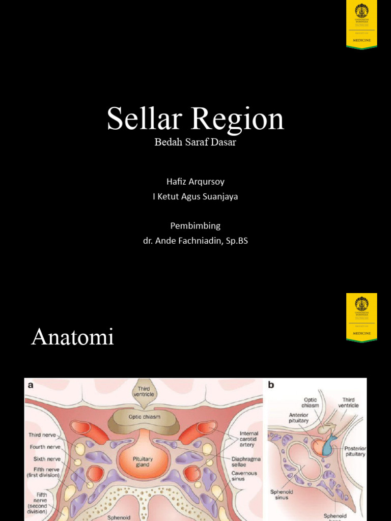 BSD Sellar Region - HA | PDF | Pituitary Gland | Neoplasms