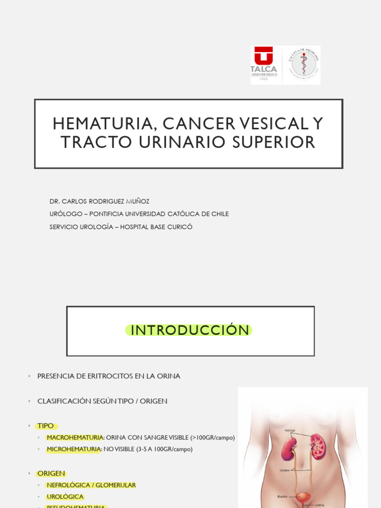Hematuria, Cáncer Vesical y Tracto Urinario Superior | PDF | Causas de ...