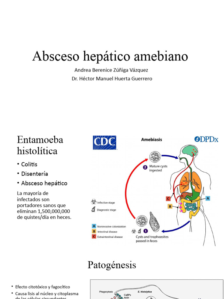 Absceso Hepático Amebiano | PDF | Especialidades Medicas | Medicina CLINICA