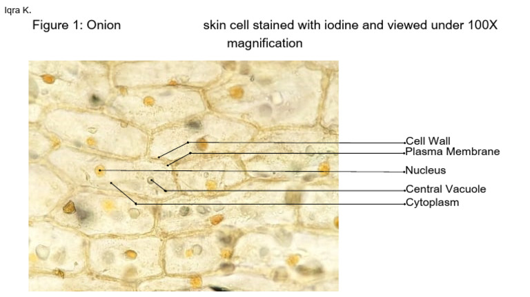 Science 10 Honors - Onion Cell Biological Drawing | PDF