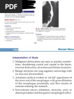 Modified Bell's Staging for NEC | PDF | Clinical Medicine | Digestive ...