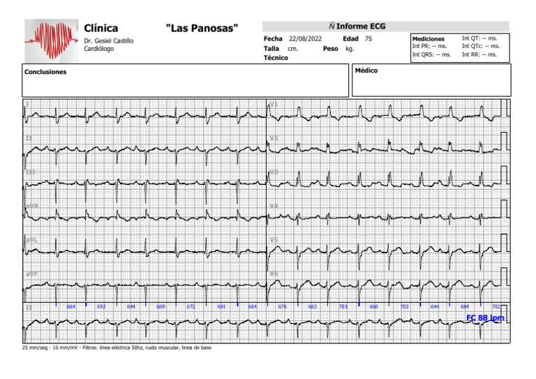 Informe Cardiológico Clínica Las Panosas | PDF