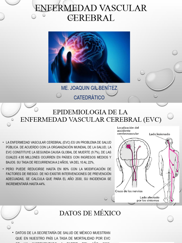 Enfermedad Vascular Cerebral | PDF
