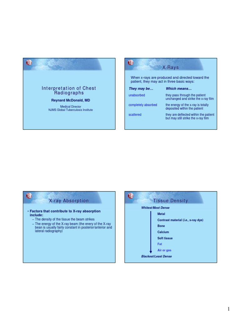 Interpreting Chest Radiographs | PDF | X Ray | Radiography