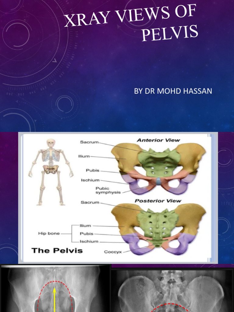 X-Ray Views of the Pelvis Explained | PDF | Pelvis | Hip