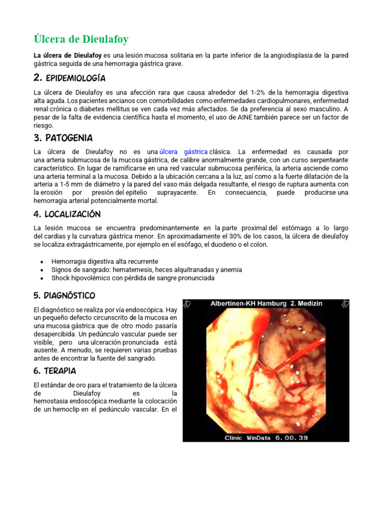 Úlcera de Dieulafoy: Causas e Tratamento | PDF