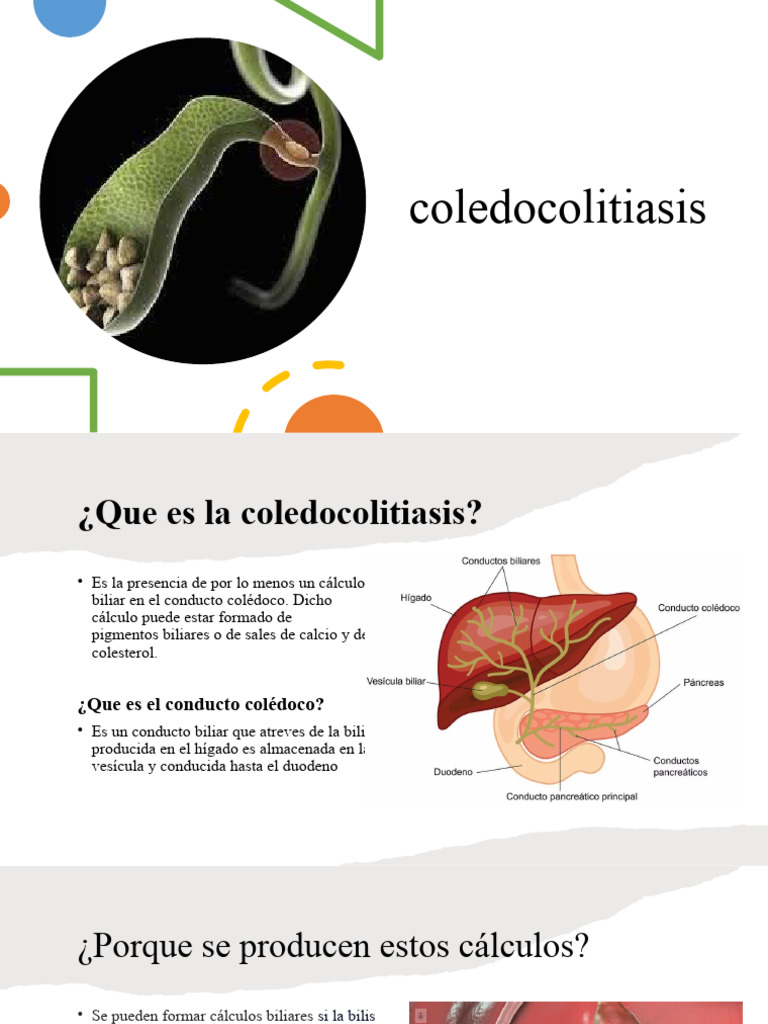 Coledocolitiasis | PDF