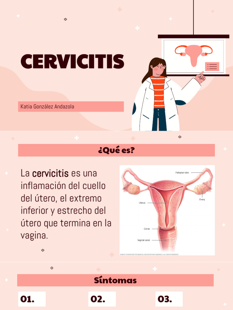 Cervicitis | PDF | Infección transmitida sexualmente | Condón