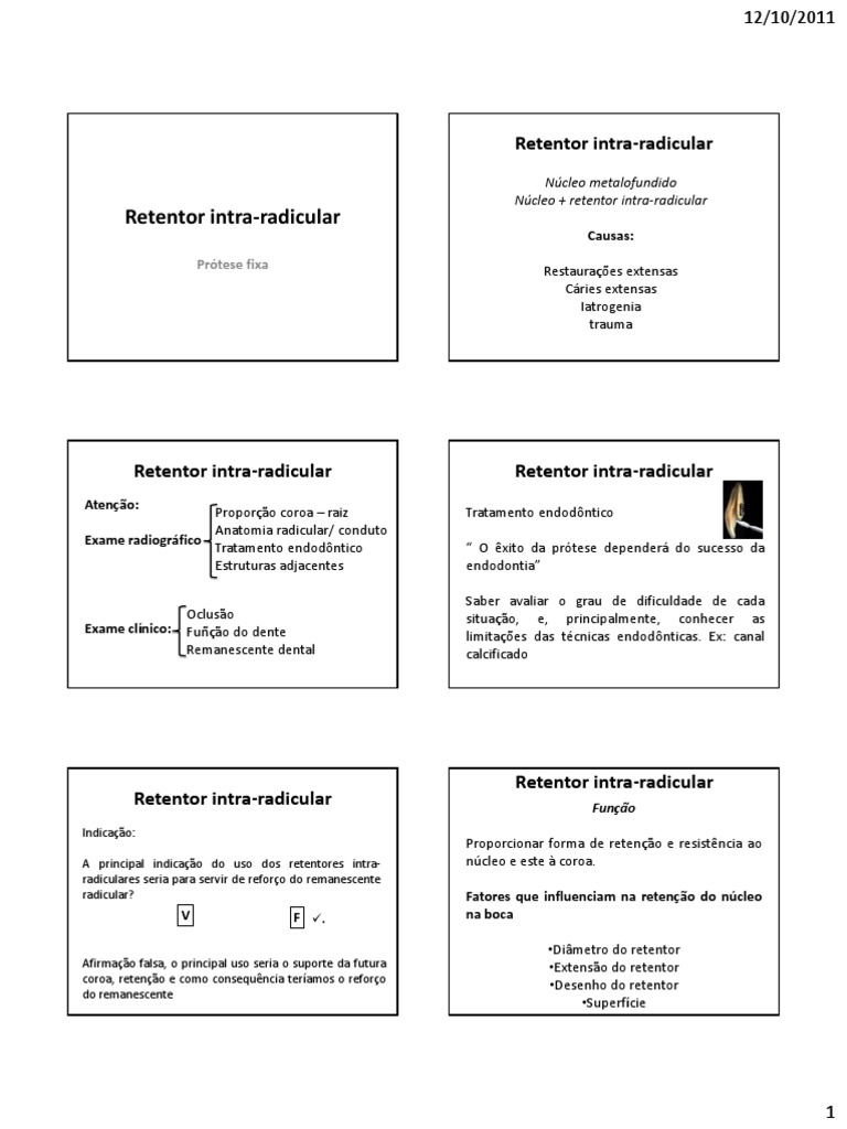 Retentor Intra-Radicular | PDF | Odontologia | Boca