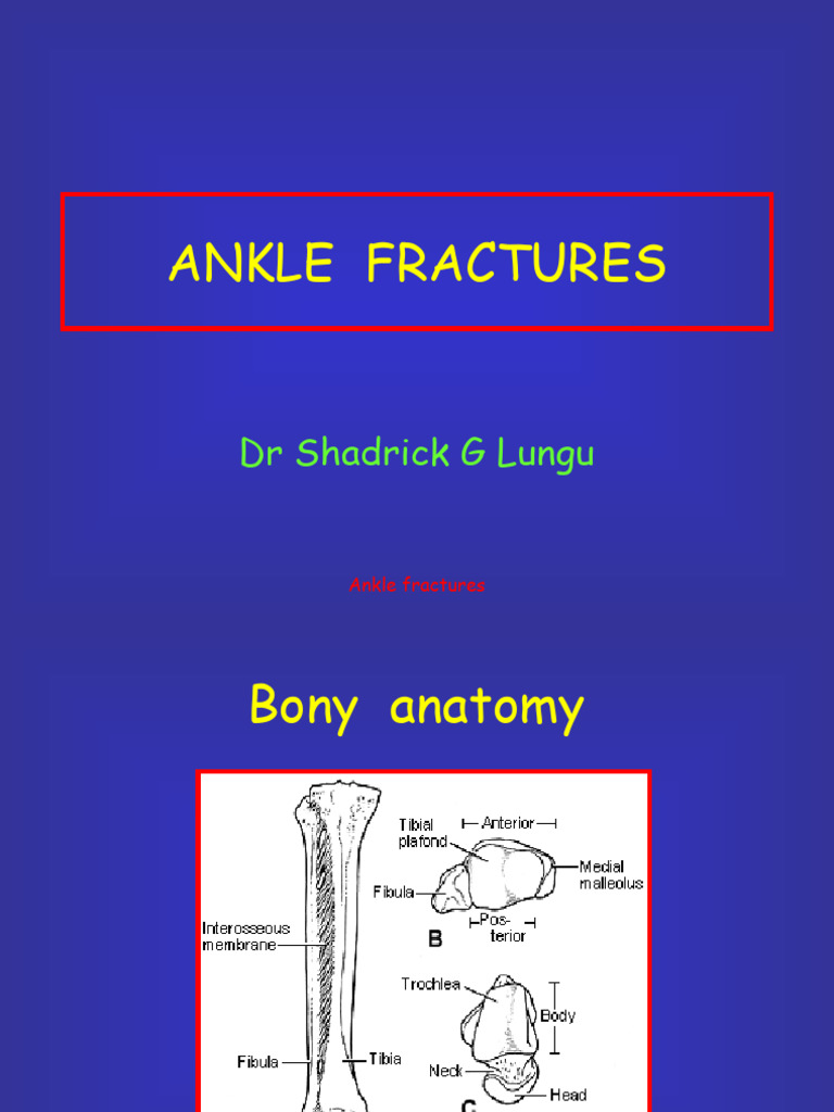 Ankle Fractures | PDF | Ankle | Anatomical Terms Of Motion