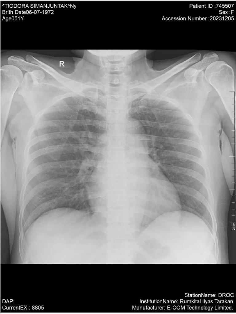 Tiodora Simanjuntak | PDF