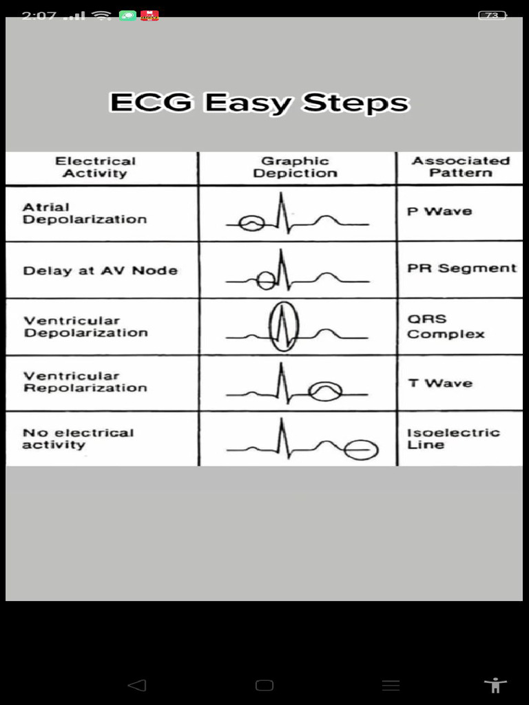 ECG (2) | PDF