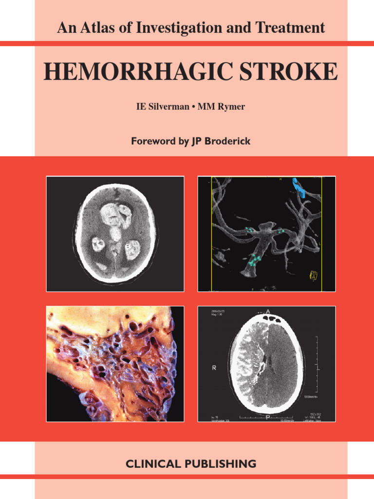An Atlas of Investigation and Treatment-Hemorrhagic Stroke | Download ...