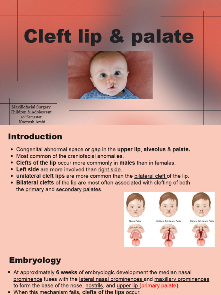 Cleft Lip & Palate | PDF | Diseases And Disorders | Medical Specialties