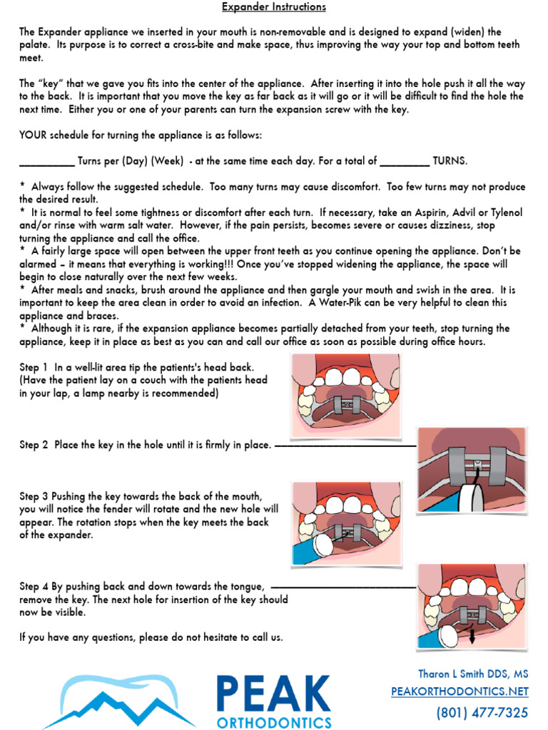 Expander Instructions 2 | PDF