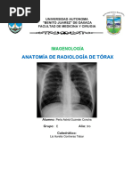 Signos radiológicos del hilio pulmonar | PDF | Pulmón | Corazón