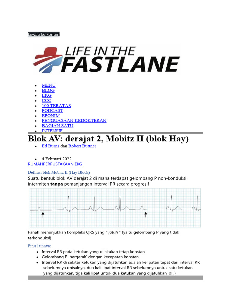 Blok AV: Derajat 2, Mobitz II (Blok Hay) | PDF | Kesehatan Holistik | Sains & Matematika