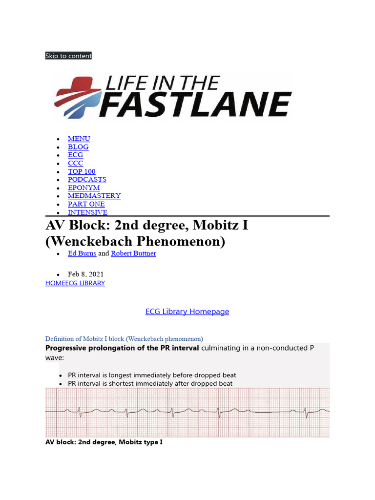AV Block: 2nd Degree, Mobitz I (Wenckebach Phenomenon) | PDF