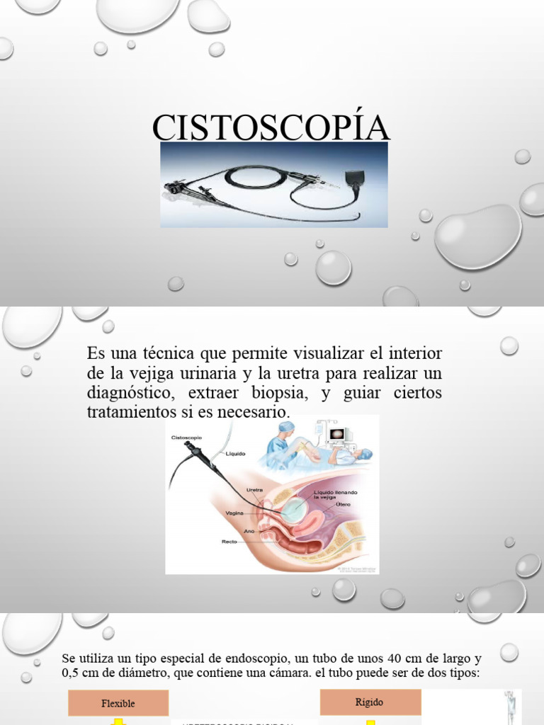 1 Cistoscopía.. | PDF | Especialidades Medicas | Medicina CLINICA