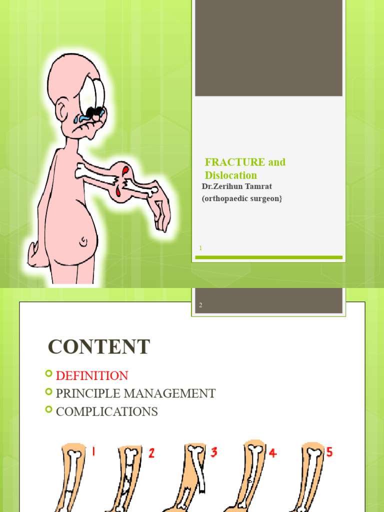 Fracture Lecture (Dr. Zerihun) | PDF | Injury | Shock (Circulatory)